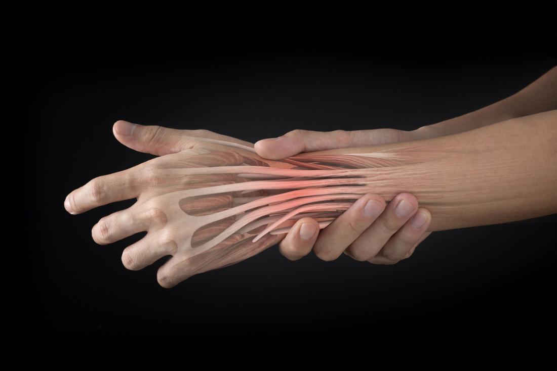 Prevenire e curare la tendinite - Virtua Salute