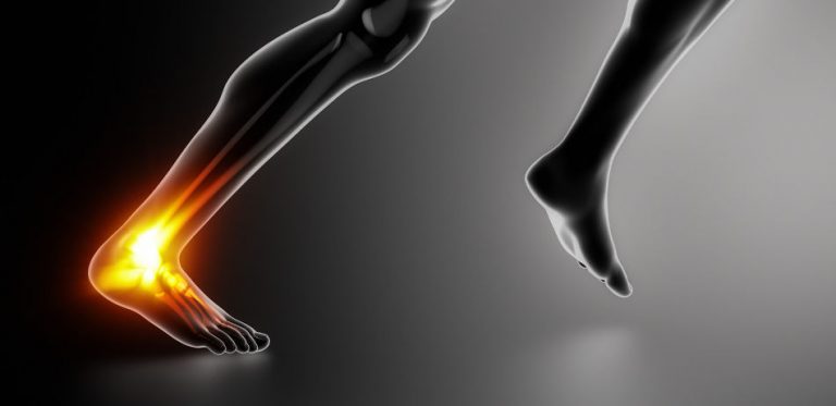 Tendine rotto: trattamenti non-chirurgici - Virtua Salute